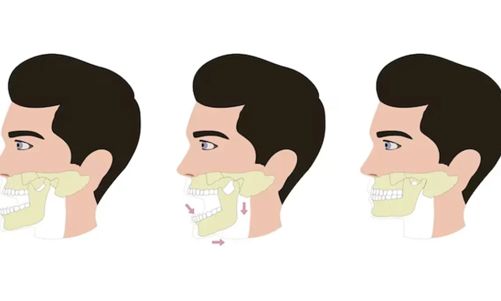 Uneven Jaw Explained: What It Is And How To Fix It